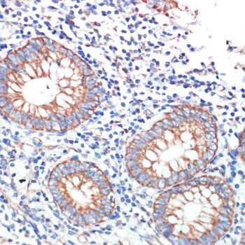 AFG3L2抗体 (GTX66373) | GeneTex中国官方网站