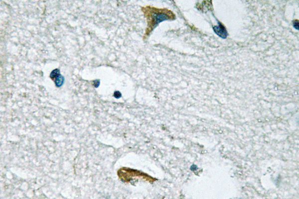 JAK3抗体 (GTX66640) | GeneTex中国官方网站