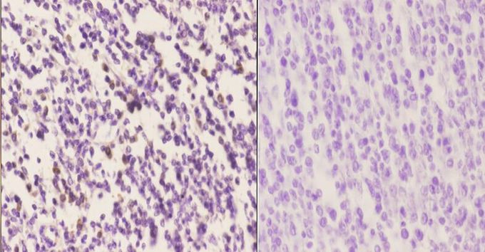 IRF4 / MUM1抗体 (GTX66692) | GeneTex中国官方网站