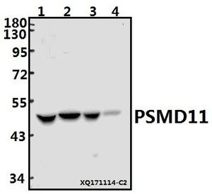PSMD11抗体 (GTX66726) | GeneTex中国官方网站