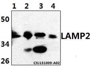 LAMP2抗体 (GTX66812) | GeneTex中国官方网站