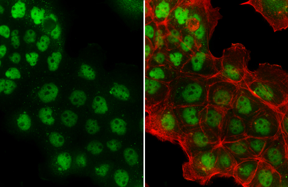 p53抗体 [Pab1801] (GTX70216) | GeneTex中国官方网站