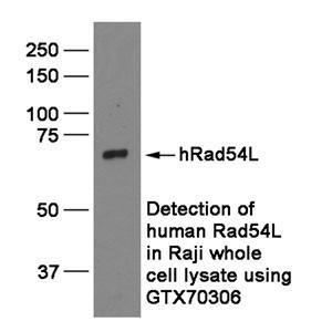 RAD54L antibody [60.1]价格,详情介绍-960化工网 – 960化工网