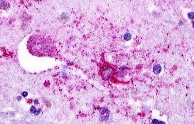 LGR5抗体 (GTX71143) | GeneTex中国官方网站