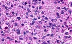 LGR5抗体 (GTX71143) | GeneTex中国官方网站