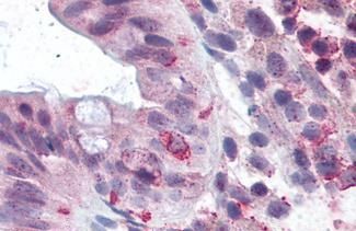 LGR5抗体 (GTX71143) | GeneTex中国官方网站