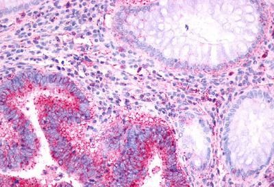 GPR37抗体 (GTX71159) | GeneTex中国官方网站