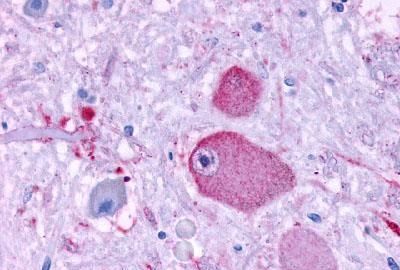 GPR37抗体 (GTX71159) | GeneTex中国官方网站