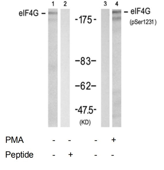 EIF4G (phospho Ser1231)抗体 (GTX79087) | GeneTex中国官方网站