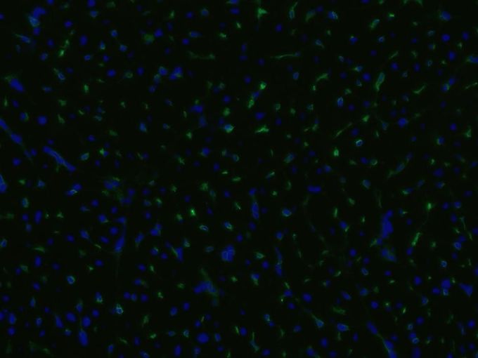 CD105抗体 [MEM-229] (PE) (GTX79975) | GeneTex中国官方网站