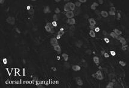 VR1/ TRPV1抗体 (GTX80798) | GeneTex中国官方网站