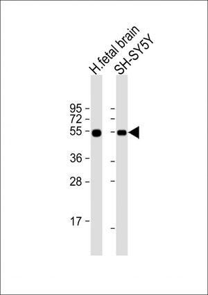 EN1抗体, N-term (GTX81554) | GeneTex中国官方网站