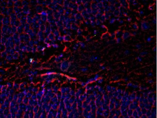 beta Tubulin 3/ Tuj1抗体 [AA10] (GTX82572) | GeneTex中国官方网站