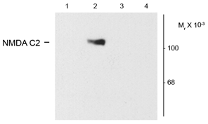 NMDAR1 (splice variant C2)抗体 (GTX82639) | GeneTex中国官方网站