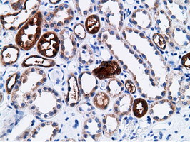 CD80抗体 [2B11] (GTX84701) | GeneTex中国官方网站