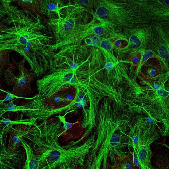 beta Tubulin 3/ Tuj1抗体 (GTX85469) | GeneTex中国官方网站