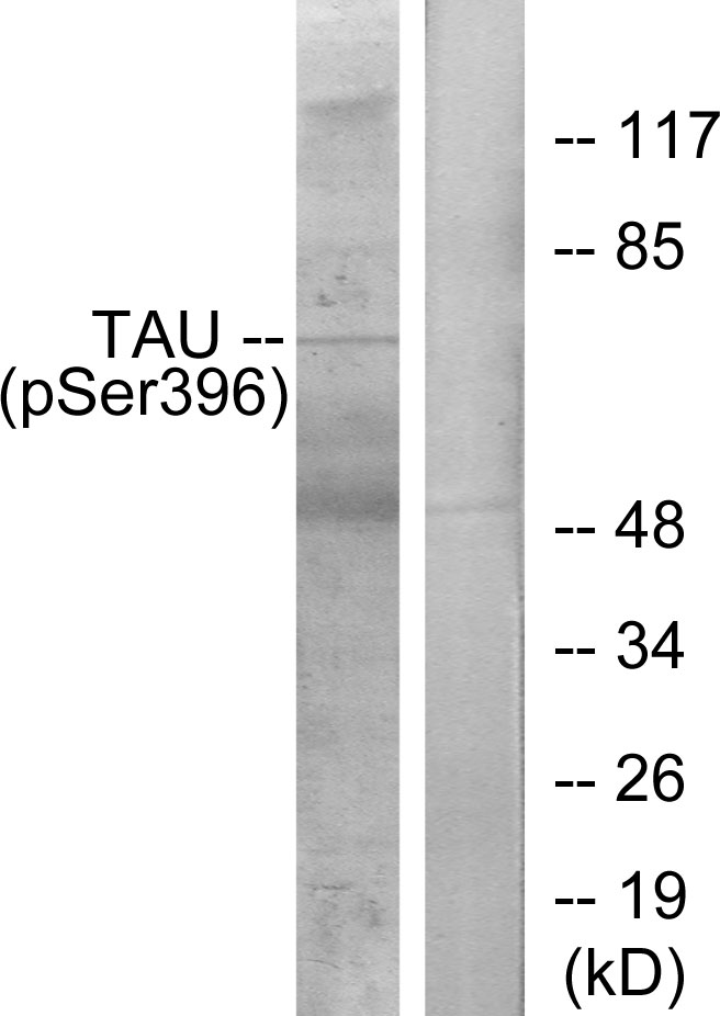 Tau (phospho Ser396)抗体 (GTX86695) | GeneTex中国官方网站
