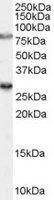 SV2A antibody, Internal价格,详情介绍-960化工网 – 960化工网