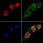 RUNX2抗体 (GTX00792) | GeneTex中国官方网站