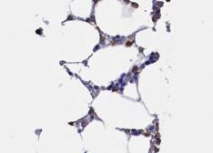 RUNX2抗体 (GTX00792) | GeneTex中国官方网站