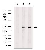 RUNX2抗体 (GTX00792) | GeneTex中国官方网站