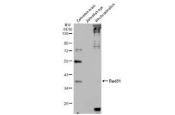 Rad51抗体 [N1C2] (GTX100469) | GeneTex中国官方网站
