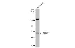 GAD67抗体 (GTX101881) | GeneTex中国官方网站