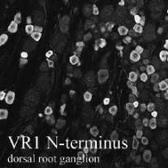 VR1/ TRPV1抗体 (GTX10296) | GeneTex中国官方网站