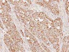 SUCLG1抗体 (GTX109215) | GeneTex中国官方网站