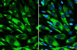 COL1A1抗体 [N1N2], N-term (GTX112731) | GeneTex中国官方网站