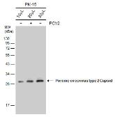Porcine circovirus type 2 / PCV2 Capsid抗体 (GTX128121) | GeneTex中国官方网站