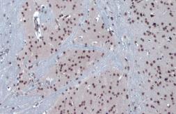 PERK抗体 (GTX129275) | GeneTex中国官方网站