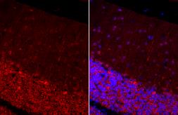 MAP2抗体 (GTX133109) | GeneTex中国官方网站