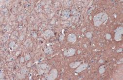 MAP2抗体 (GTX133109) | GeneTex中国官方网站