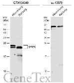 SFTPC抗体 (GTX134340) | GeneTex中国官方网站