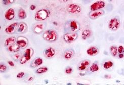 ADAMTS5抗体 (GTX13976) | GeneTex中国官方网站