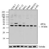 eIF2 alpha抗体 [EIF2a] (GTX25369) | GeneTex中国官方网站