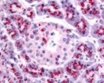 TERT抗体 [2C4] (GTX30410) | GeneTex中国官方网站