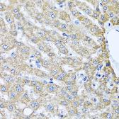 TMEM189抗体 (GTX32926) | GeneTex中国官方网站