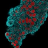 Cytokeratin 19抗体 [KRT19/800] (GTX34651) | GeneTex中国官方网站