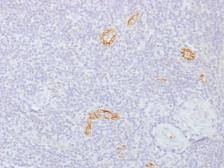 GJB1抗体 [GJB1/1753] (GTX34760) | GeneTex中国官方网站