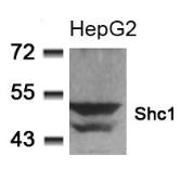 SHC1抗体 (GTX50620) | GeneTex中国官方网站