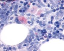 Myc tag抗体 (FITC) (GTX77377) | GeneTex中国官方网站