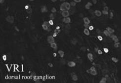 VR1/ TRPV1抗体 (GTX80798) | GeneTex中国官方网站