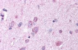 GPR37抗体 (GTX85873) | GeneTex中国官方网站