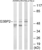 G3BP2抗体 (GTX87055) | GeneTex中国官方网站