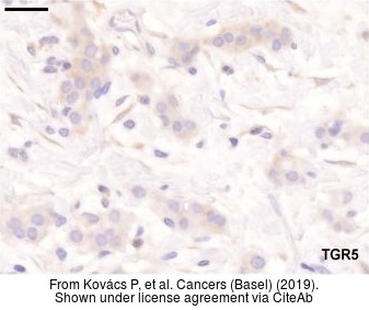 TGR5抗体 [C2C3], C-term (GTX100026) | GeneTex中国官方网站