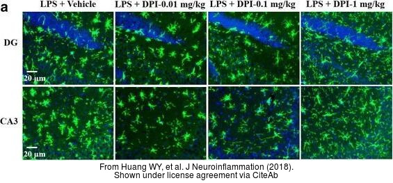 Iba1抗体 (GTX100042) | GeneTex中国官方网站