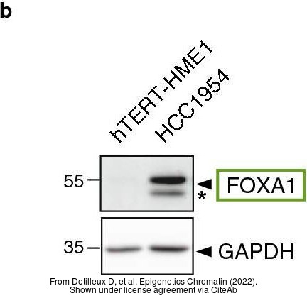 FOXA1抗体 (GTX100308) | GeneTex中国官方网站