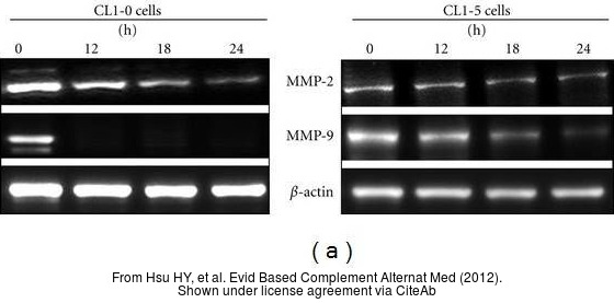 MMP9抗体 [N2C1], Internal (GTX100458) | GeneTex中国官方网站